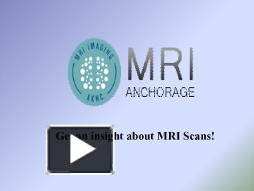 PPT – Get an insight about MRI Scans! PowerPoint presentation | free to ...