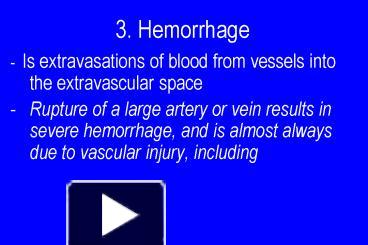 3. Hemorrhage presentation | free to download