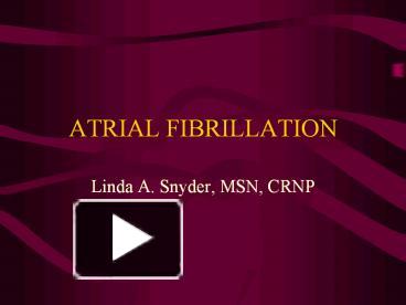 ATRIAL FIBRILLATION presentation | free to view
