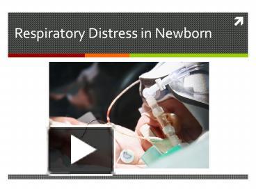 Neonatal Respiratory Distress presentation | free to download