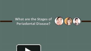 What are the Stages of Periodontal Disease presentation | free to download