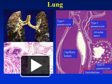 Lung presentation | free to view