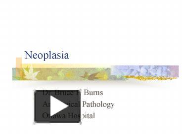 Neoplasia presentation | free to download
