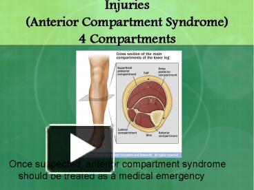 Injuries (Anterior Compartment Syndrome) 4 Compartments presentation ...