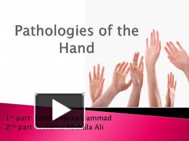 PPT – Pathologies of the Hand PowerPoint presentation | free to ...