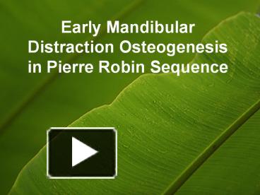 PPT – Early Mandibular Distraction Osteogenesis in Pierre Robin ...