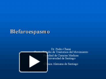 PPT – Blefaroespasmo PowerPoint presentation | free to download - id ...