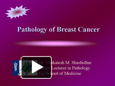 Pathology of Breast Cancer presentation | free to view