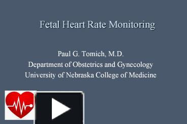 Fetal Heart Rate Monitoring presentation | free to view