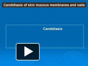 PPT – Candidiasis of skin mucous membranes and nails PowerPoint ...