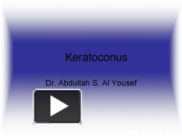 Keratoconus presentation | free to download