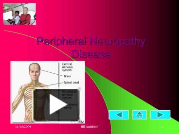 PPT – Peripheral Neuropathy Disease PowerPoint presentation | free to ...