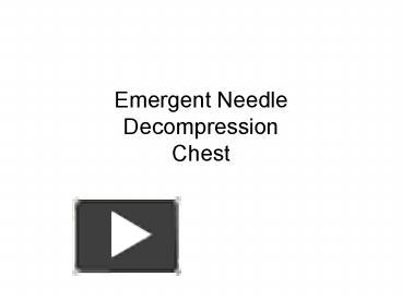 Emergent Needle Decompression Chest presentation | free to view