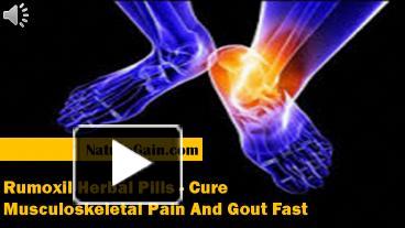PPT – Rumoxil Herbal Pills - Cure Musculoskeletal Pain And Gout Fast ...