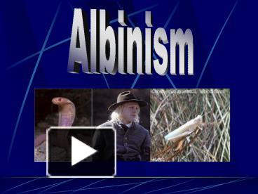 Albinism presentation | free to view