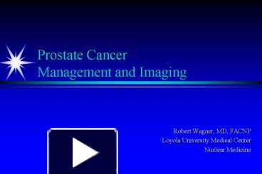 PPT – Prostate Cancer Management and Imaging PowerPoint presentation ...