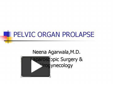 PELVIC ORGAN PROLAPSE presentation | free to view