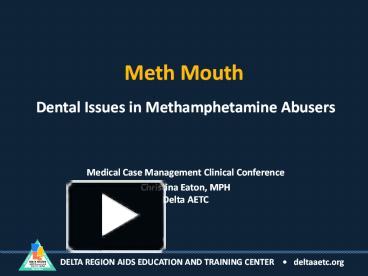 Meth Mouth presentation | free to download
