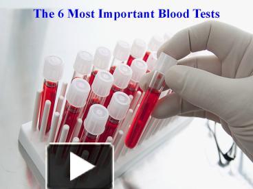 PPT – The 6 Most Important Blood Tests PowerPoint presentation | free ...
