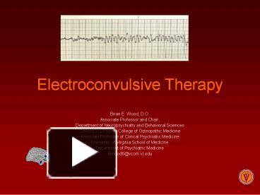 Electroconvulsive Therapy presentation | free to view