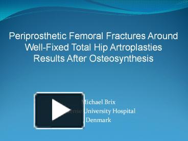 Michael Brix presentation | free to view