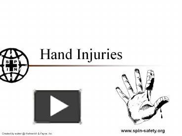 PPT – Hand Injuries PowerPoint presentation | free to download - id ...