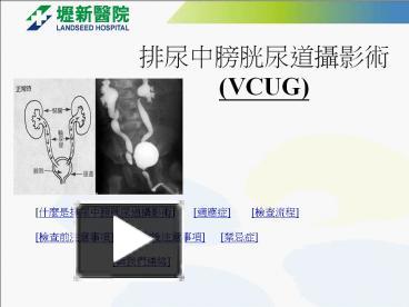 PPT – ??????????(VCUG) PowerPoint presentation | free to download - id ...