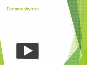 Dermatophytosis presentation | free to download