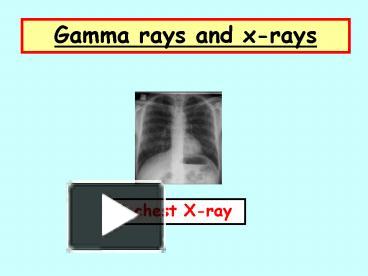 Gamma rays and xrays presentation | free to view