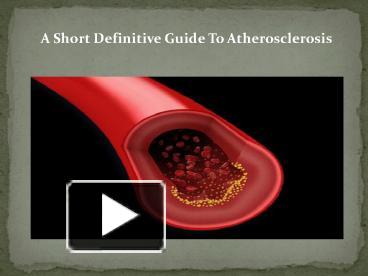 PPT – Short Definitive Guide To Atherosclerosis PowerPoint presentation ...