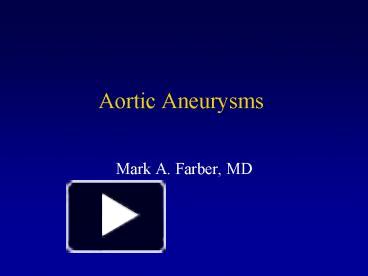 Aortic Aneurysms presentation | free to view
