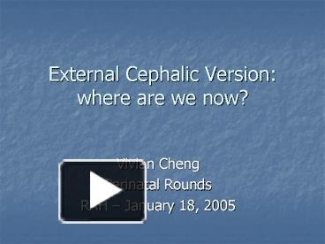 External Cephalic Version: where are we now presentation | free to view