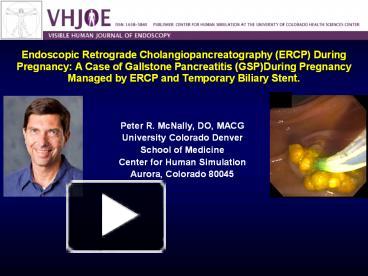 Endoscopic Retrograde Cholangiopancreatography (ERCP) During Pregnancy ...