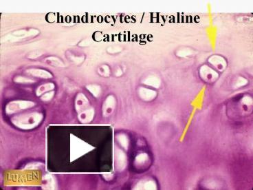 Chondrocytes / Hyaline Cartilage presentation | free to download