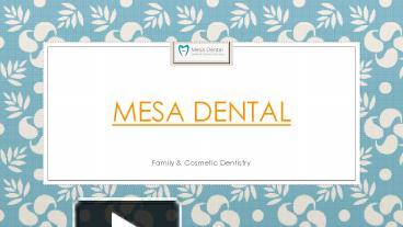 PPT – Mesa Dental (1) PowerPoint presentation | free to download - id ...