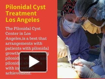 Pilonidal Cyst Treatment presentation | free to download
