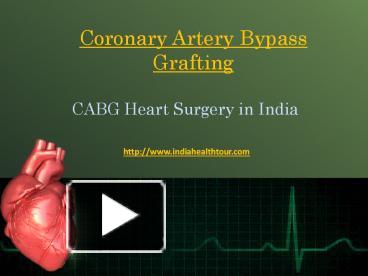 CABG Heart Surgery in India presentation | free to download