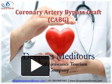PPT – Things you need to know about CABG PowerPoint presentation | free ...