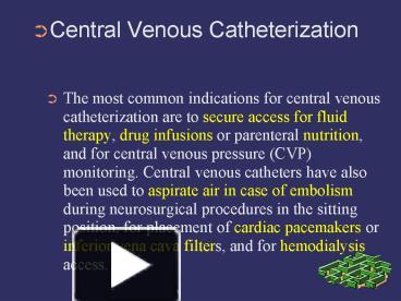 Central Venous Catheterization presentation | free to view