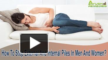 PPT – How To Stop External And Internal Piles In Men And Women ...