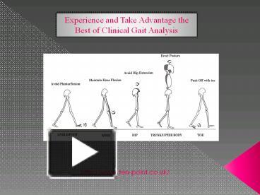PPT – Experience and Take Advantage the Best of Clinical Gait Analysis ...
