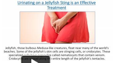 Urinating on a Jellyfish Sting is an Effective Treatment presentation ...