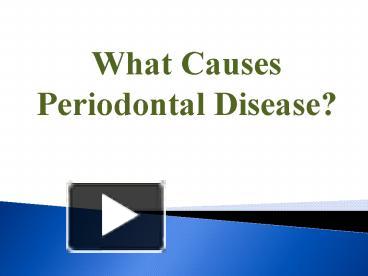 PPT – What Causes Periodontal Disease? PowerPoint presentation | free ...
