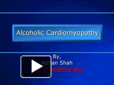 Alcoholic Cardiomyopathy presentation | free to view