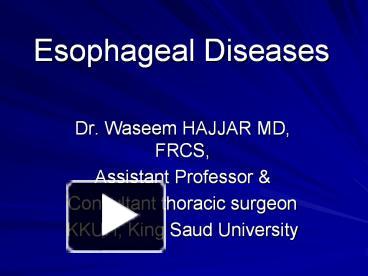 PPT – Esophageal Diseases PowerPoint presentation | free to view - id ...