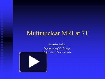 PPT – Multinuclear MRI at 7T PowerPoint presentation | free to download ...