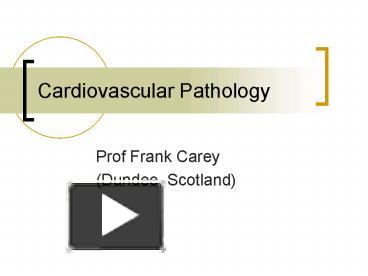 PPT – Cardiovascular Pathology PowerPoint presentation | free to view ...