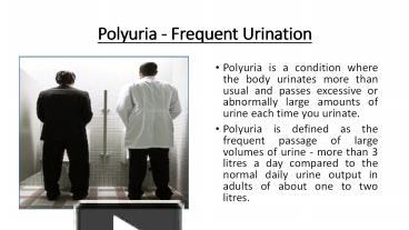 Polyuria - Frequent Urination presentation | free to download