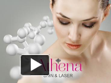 PPT – Athena Skin, Hair & Laser Clinic PowerPoint presentation | free ...