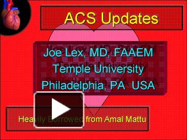 PPT – ACS Updates PowerPoint presentation | free to view - id: 811ba-ZDc1Z